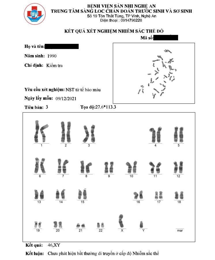 Xét nghiệm nhiễm sắc thể đồ | Khoa học thường thức
